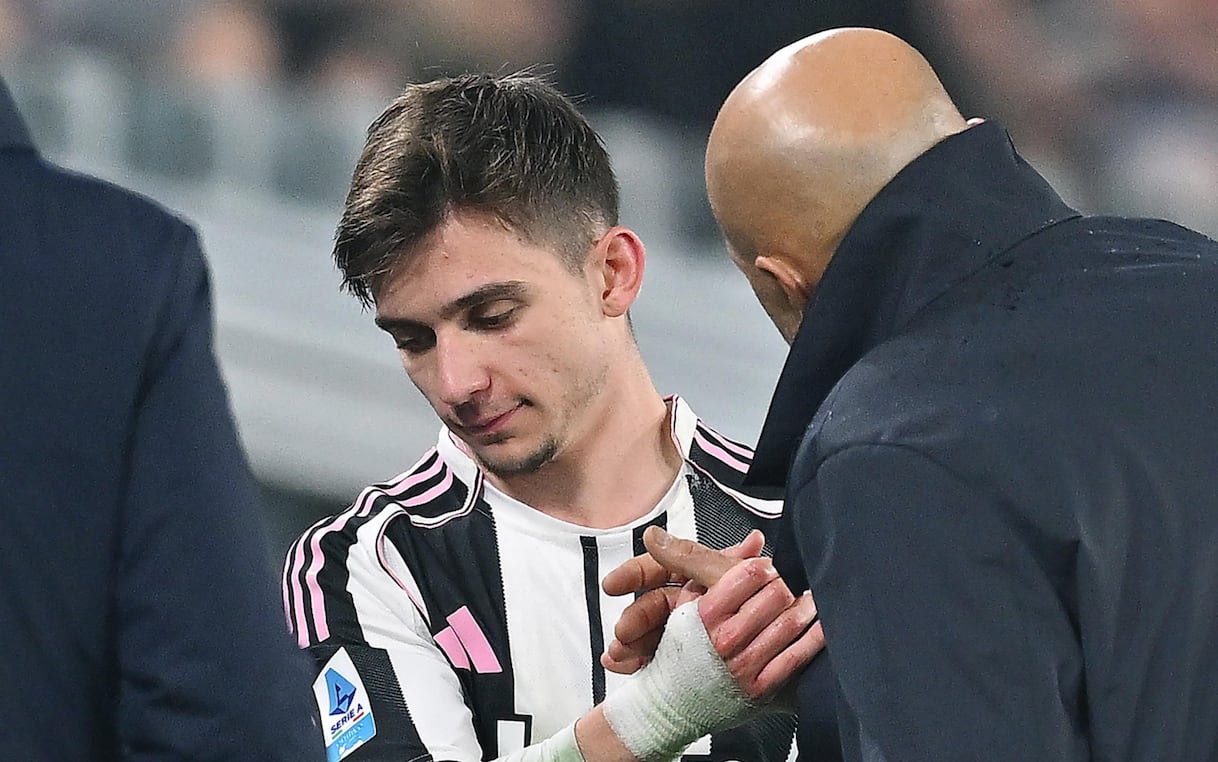 Juventus, Francisco Conceiçao: 'Voglio vincere titoli e migliorare su ...